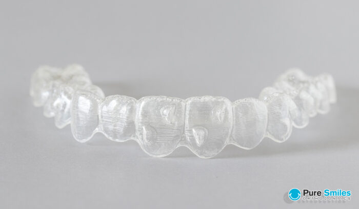 Invisalign Attachments Allow More Patients to Use the Treatment - Pure ...
