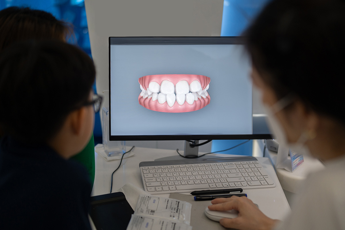 Invisalign Attachments Allow More Patients to Use the Treatment - Pure ...